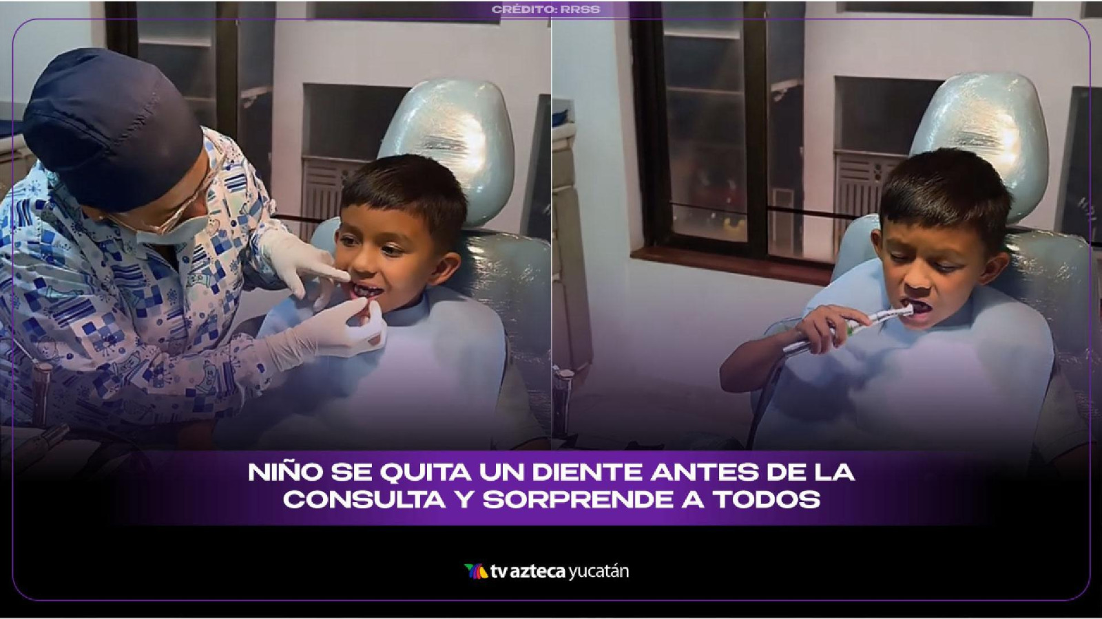 Niño dentista termina sacándose el diente él solito